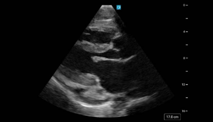 Internal Medicine Residency Point of Care Ultrasound Pathway | Graduate ...