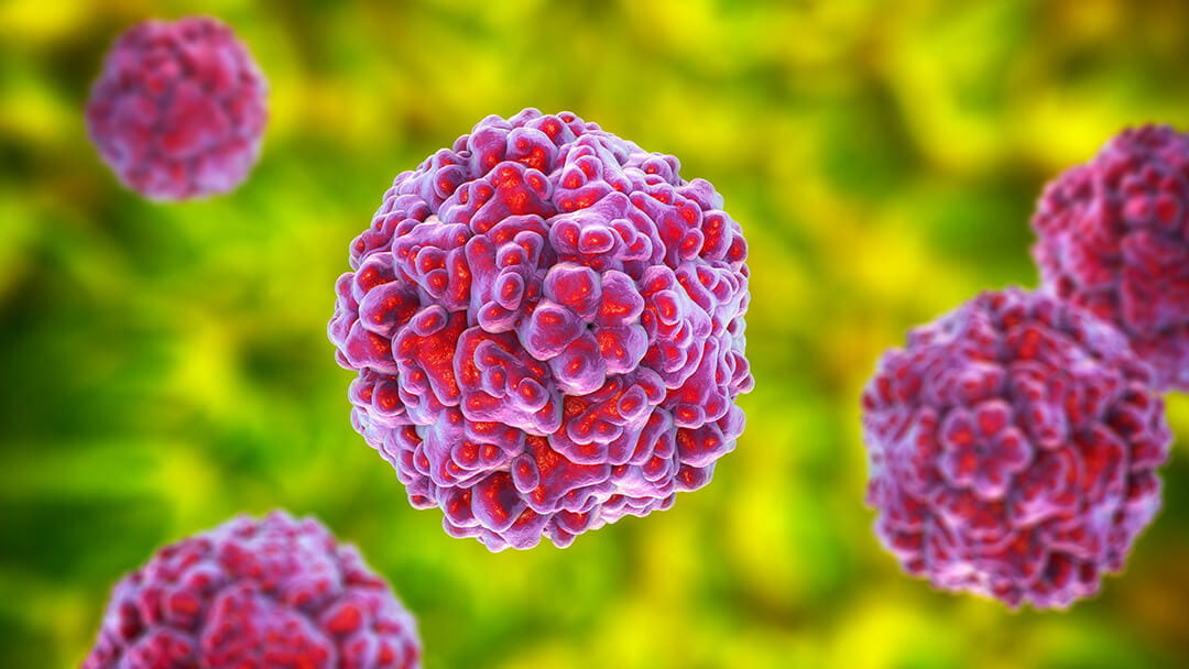 The Re-Emergence of Polio: What You Need to Know | University Hospitals