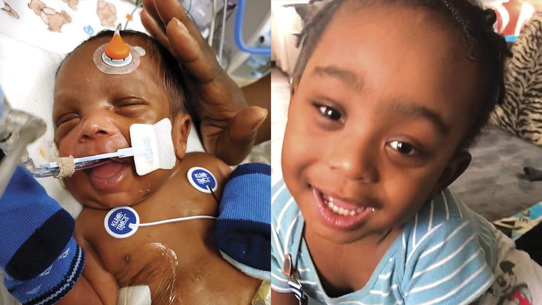 Toddler Thrives After Receiving Kidney Transplant | University Hospitals