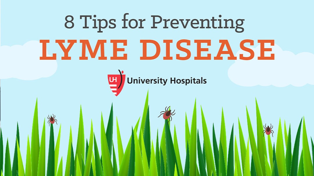 8 Tips to Prevent Lyme Disease | University Hospitals