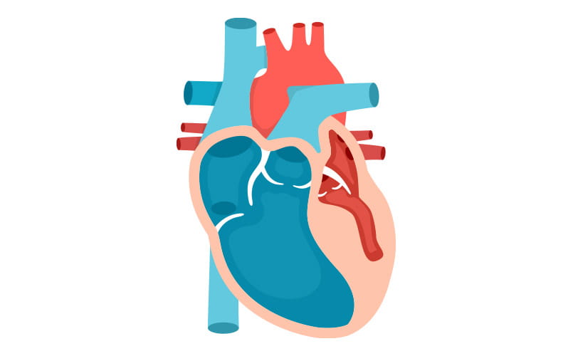 Hypertrophic Cardiomyopathy | University Hospitals | University Hospitals