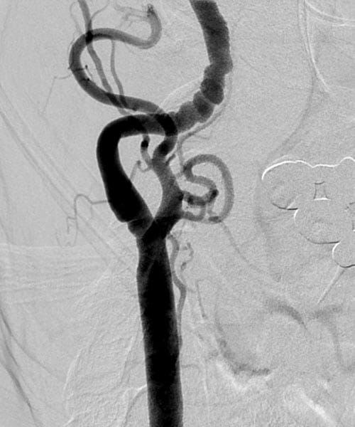 Images of FMD - JapaneseClass.jp