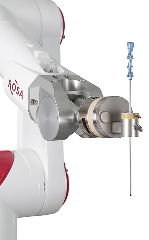 ROSA ONE Brain Robotic System | University Hospitals | University Hospitals