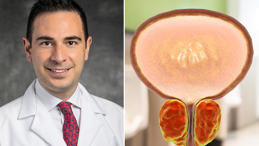 Prostate and BPH Overview | University Hospitals