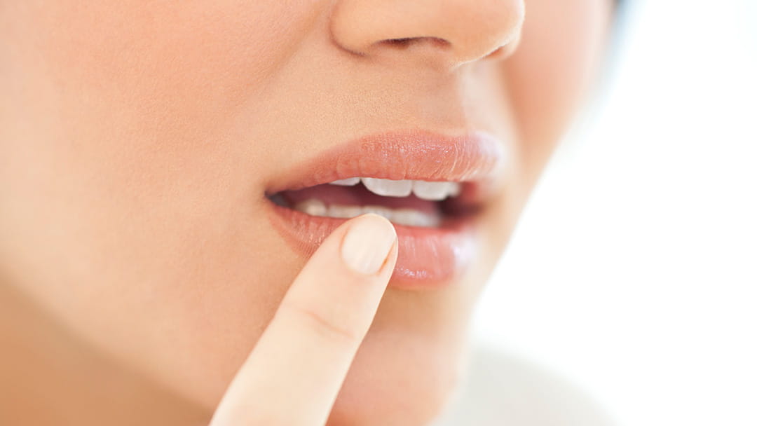 Cold Sores: Best Treatments To Ease the Pain | University Hospitals