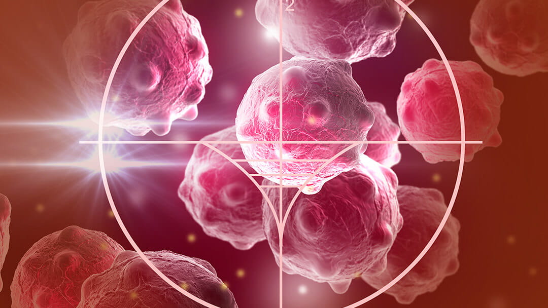 Radiation Therapy Offers Targeted Treatment, Fewer Side Effects ...