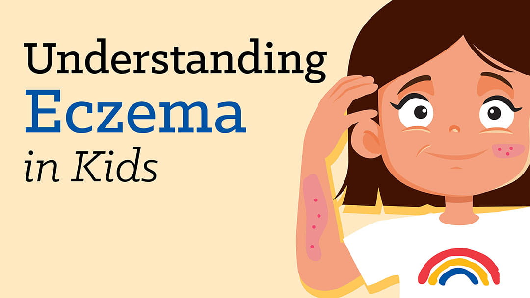 Understanding Eczema In Children University Hospitals