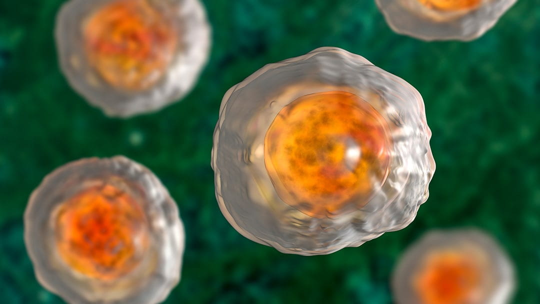 Parasite Cleanses: Hype or Helpful? | University Hospitals