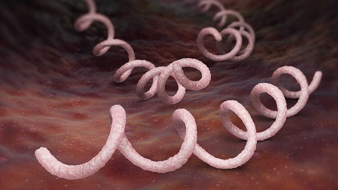 Syphilis Is Making a Big Comeback. What You Should Know. | University ...